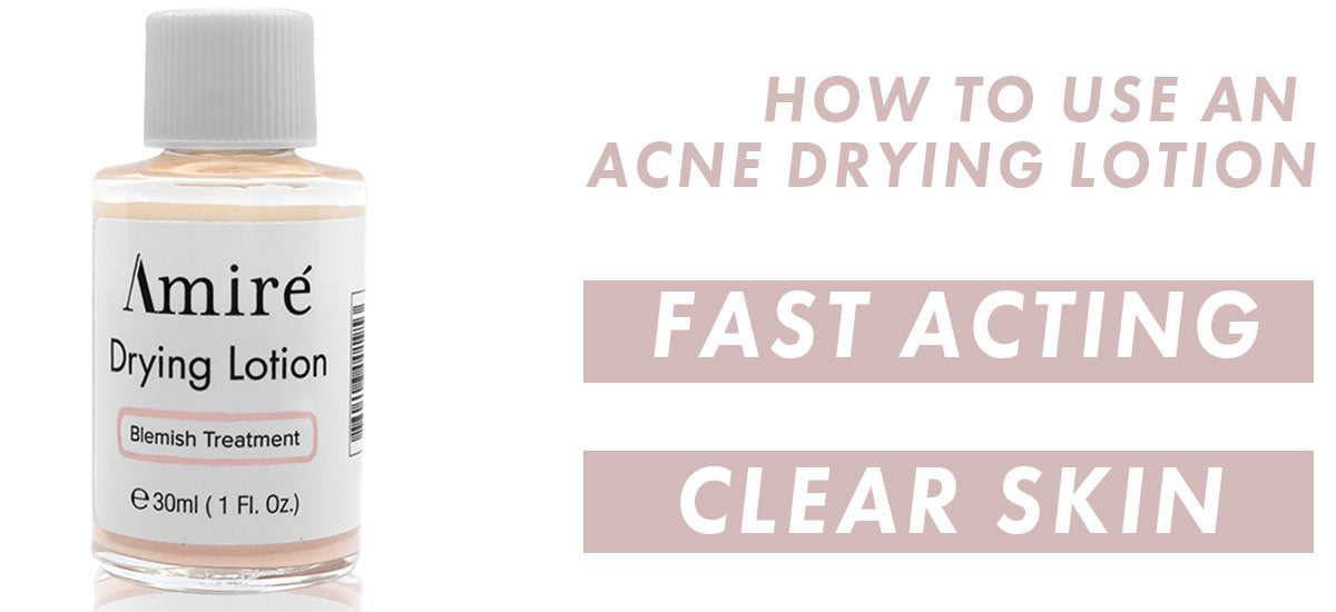 How To Use an Acne Drying Lotion – shopamire